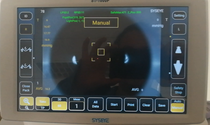 Air Puff Automatic Tonometer Non Contact Simple Operation And Easy ...