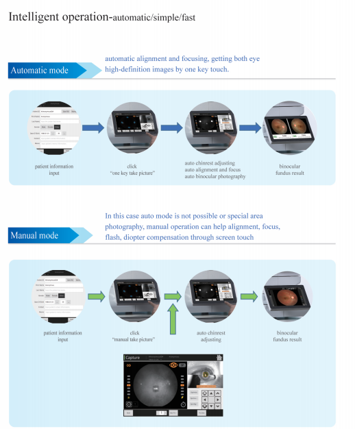 Digital Eye Fundus Camera Retinal Imaging Camera Fully Automatic