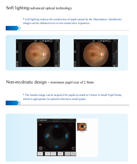 Non Mydriatic Fundus Camera Infrared LED Autofocus Assist Light ...