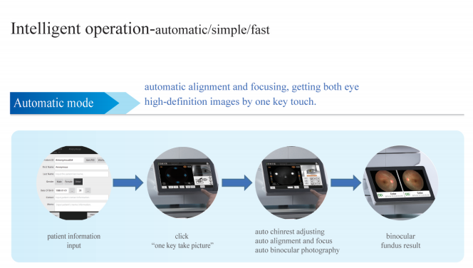 Ultra Wide Field Automated Fundus Camera Type B Photography Equipment ...