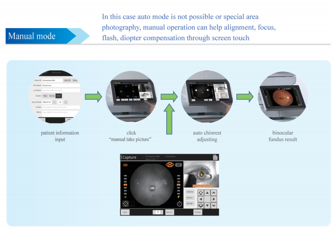 Ultra Wide Field Automated Fundus Camera Type B Photography Equipment ...