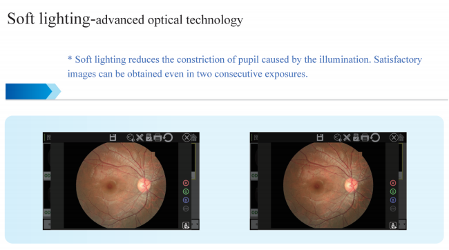 Ultra Wide Field Automated Fundus Camera Type B Photography Equipment ...
