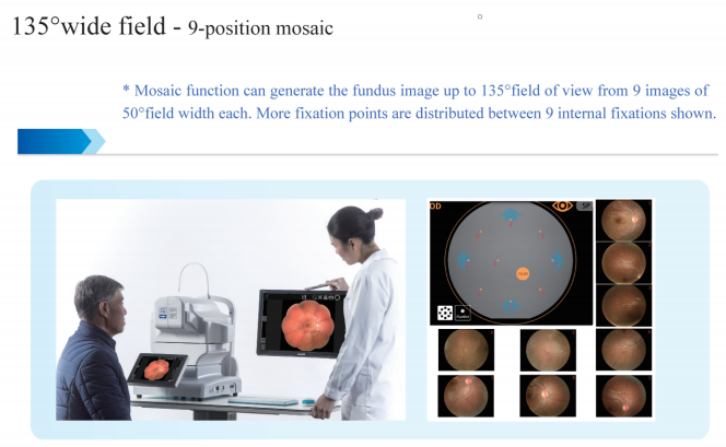 Ultra Wide Field Automated Fundus Camera Type B Photography Equipment ...