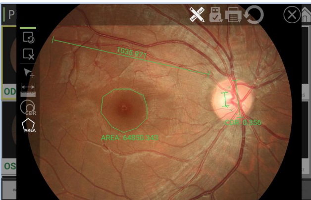 SYSEYE RetiCam 3100 Digital Fundus Camera