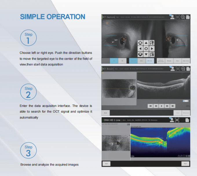 Small Pupil Alignment Optical Coherence Tomography Equipment 12mm