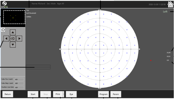 Perimeter Ophthalmic Perimetry Test Instrument 200ms Impact Body ...