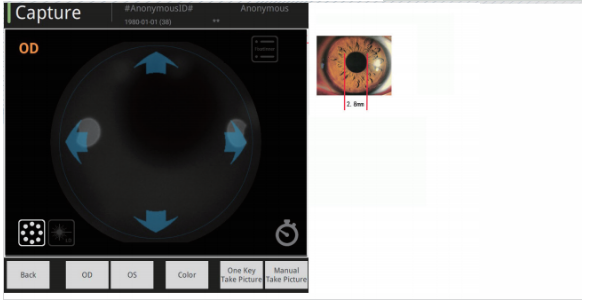 Retinal Imaging HD Fundus Images Camera Equipment 13mm Dual System