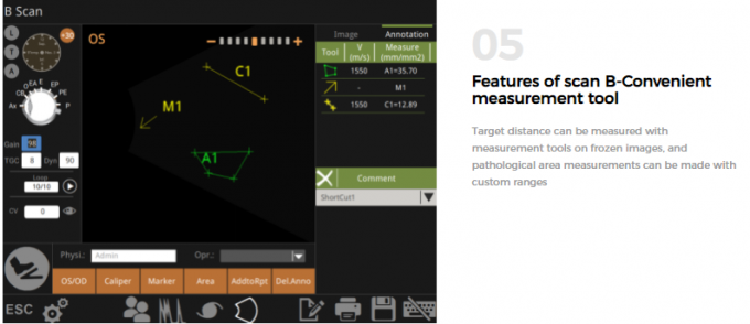 IOL Calculation Ultrasonic Scanning Machine 10MHz Convenient ...