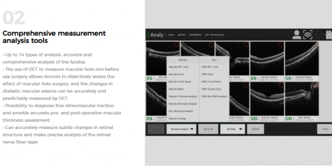 Fully Automatic SD Optical Coherence Tomography Machine Comprehensive ...
