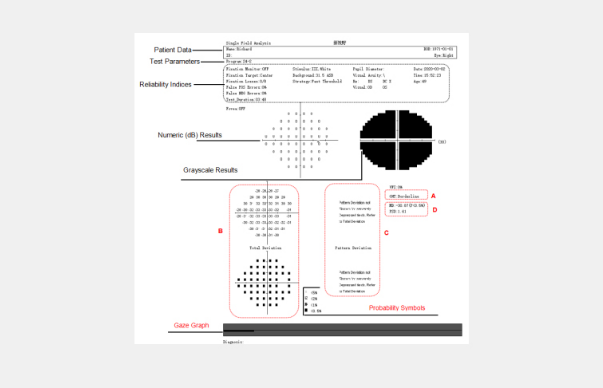 Inspection Categories 200ms Visual Field Analyzers International ...