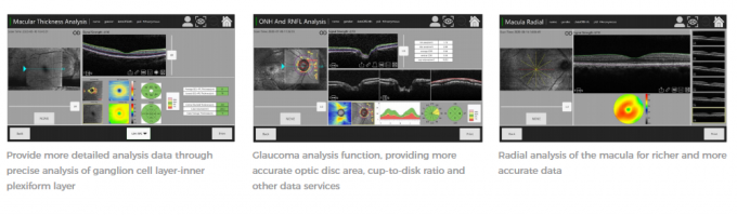 Non Contact SD OCT Machine Optical Coherence Tomography High Resolution