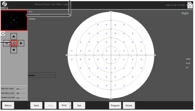 10000asb Automated Perimetry Machine 60Hz High End Computer Configuration