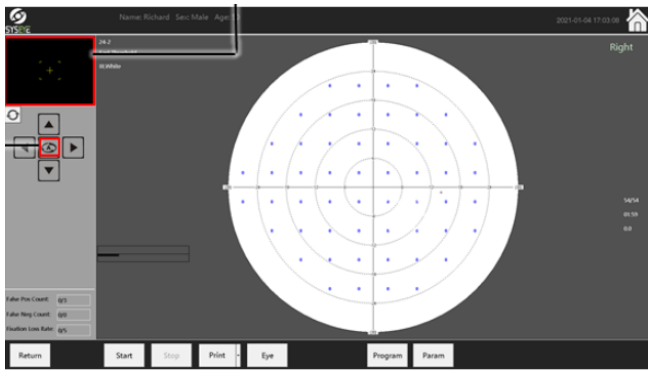 Static Automated Perimetry Machine With Abundant Inspection Modes