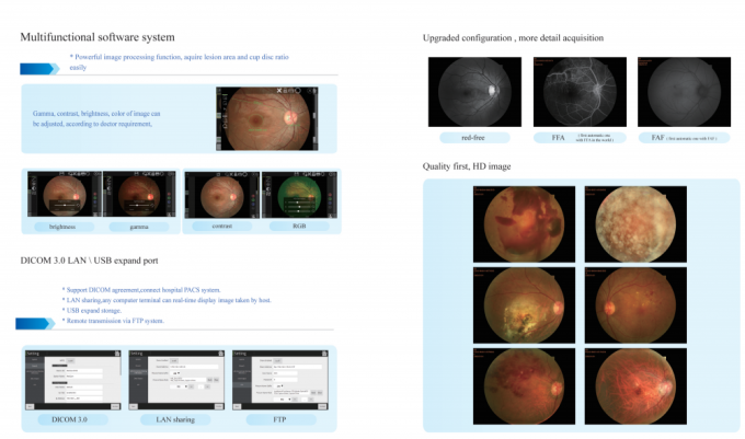 Anterior Photography Automated Fundus Camera /Red-Free/FFA//DICOM/AI System