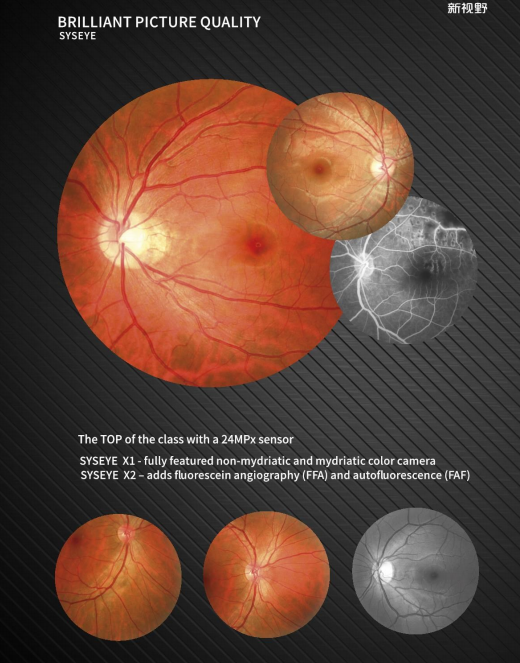 Highly Accurate Retinal Fundus Camera And Easy To Use Digital Fundus Camera