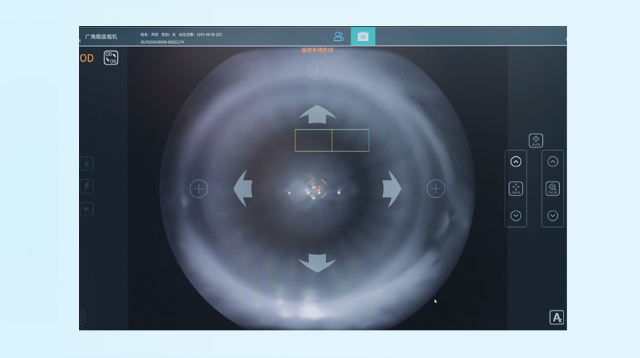 RetiCam 3100 Plus Wide Field Fundus Camera