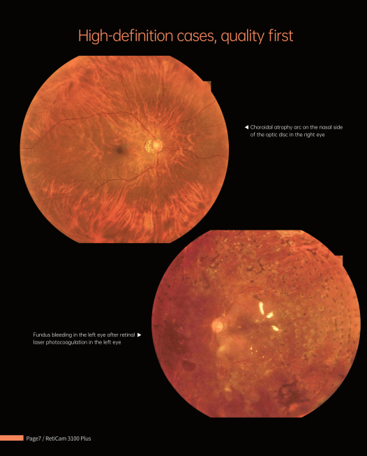 RetiCam 3100 Plus Wide Field Fundus Camera