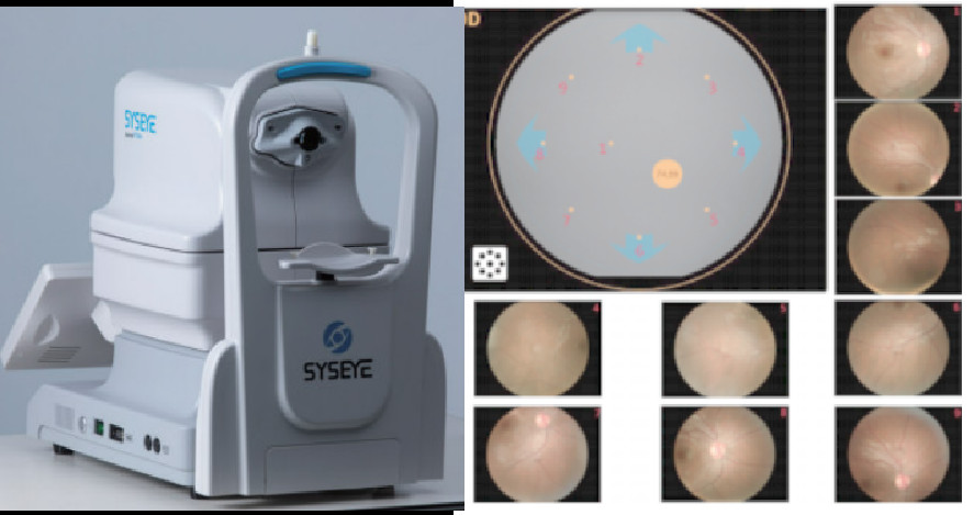 Professional Non Mydriatic Fundus Camera For Accurate Imaging