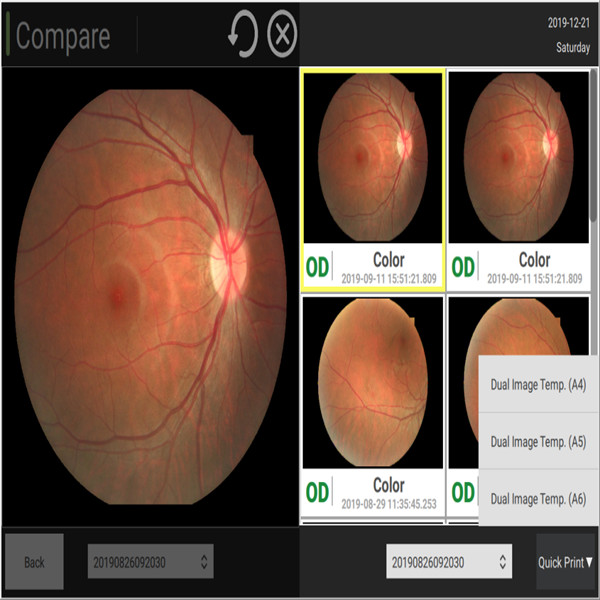 Intuitive Ultra Wide Field Fundus Camera 35mm Imaging System