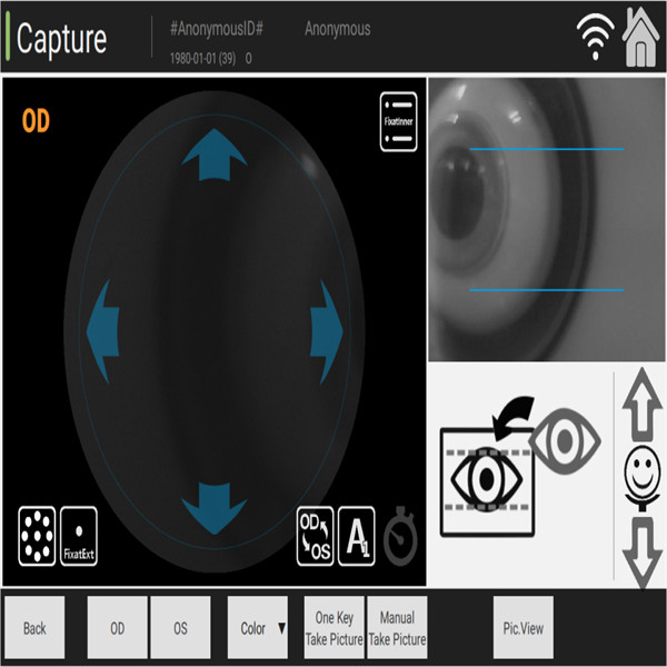 Red Free Digital Fundus Camera Non Dilated Retinal Imaging